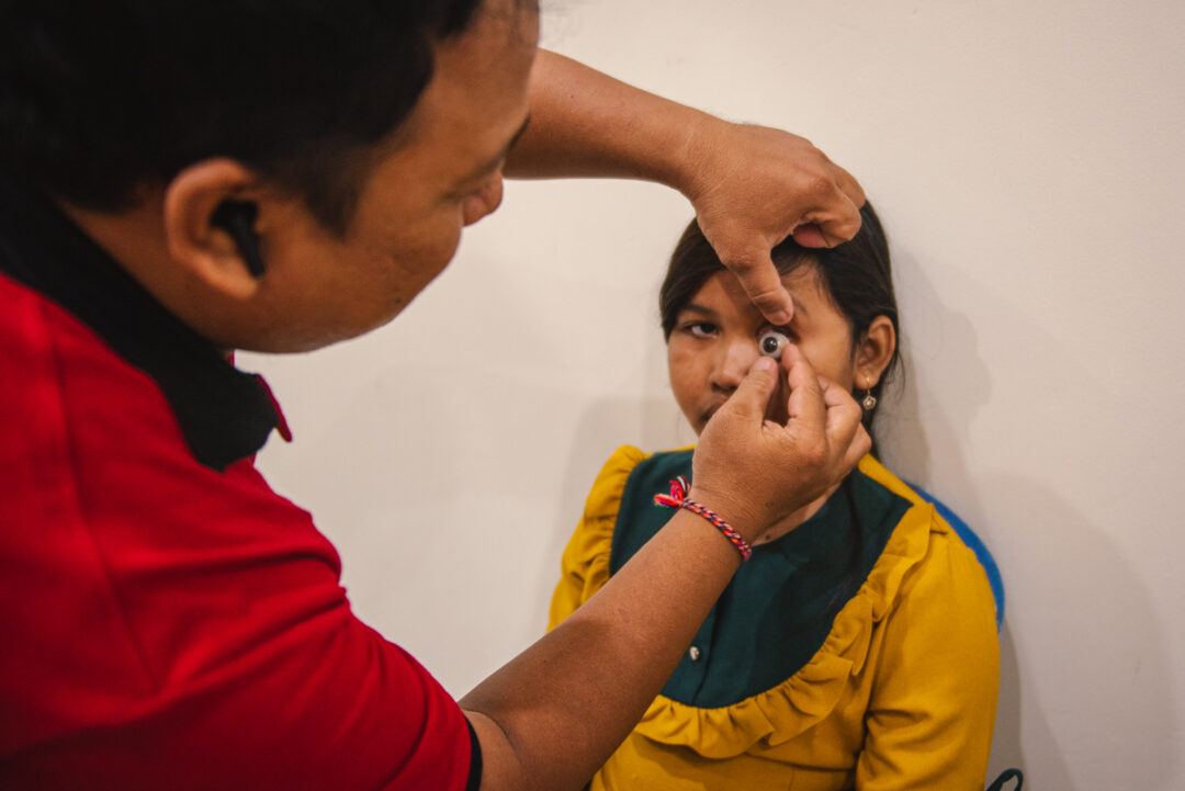 PROSTHETIC EYES - The John Fawcett Foundation